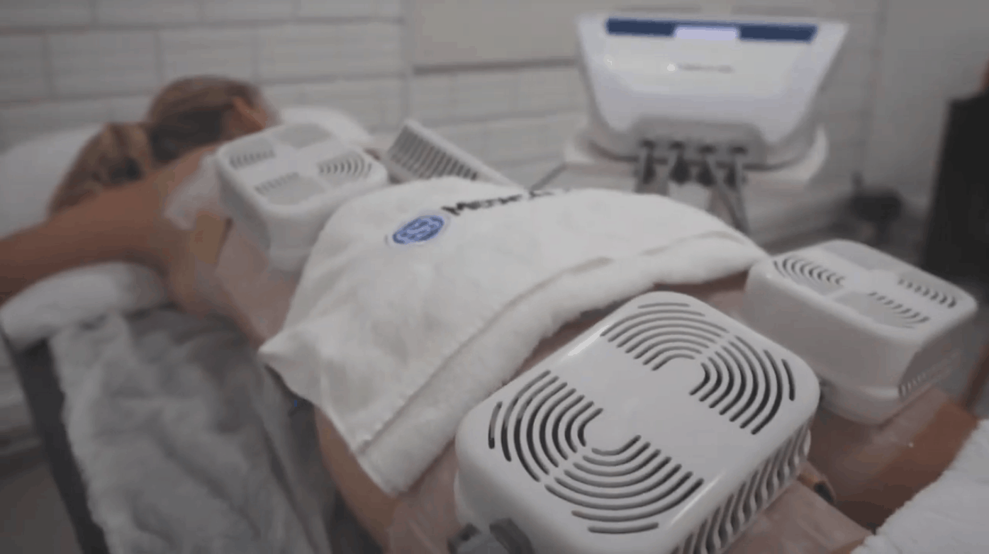 Criodermis: como funciona a criolipólise de placas da Medical San | BCMED