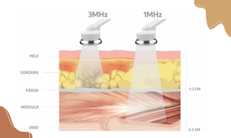 Conheça o poder do Ultrassom: 5 indicações incríveis! | BCMED