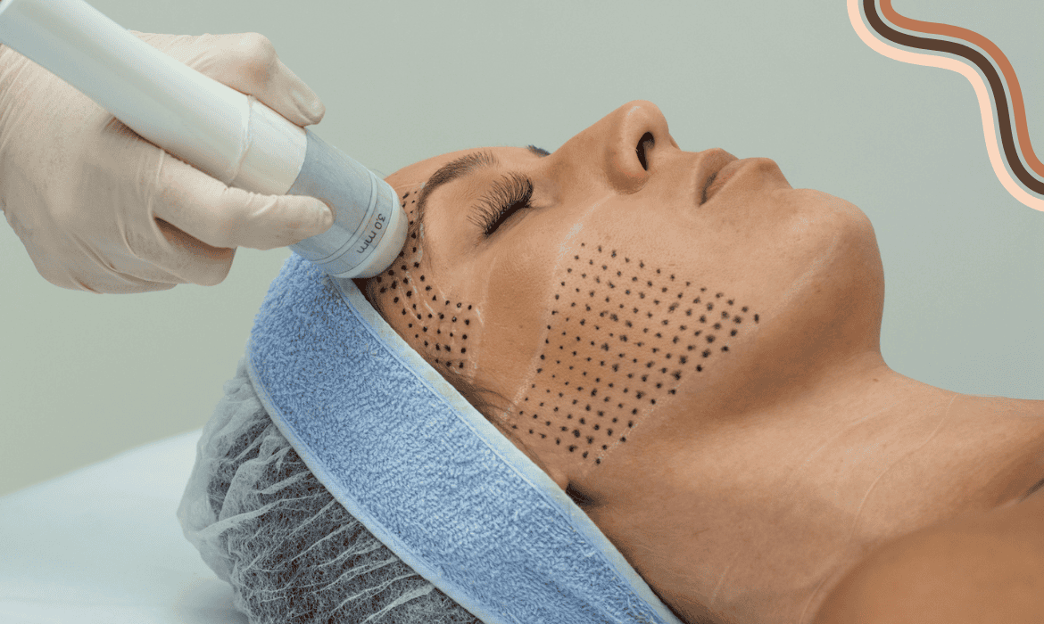 Ultrassom Focalizado de Alta Intensidade (HIFU): Tudo que Você Precisa ...