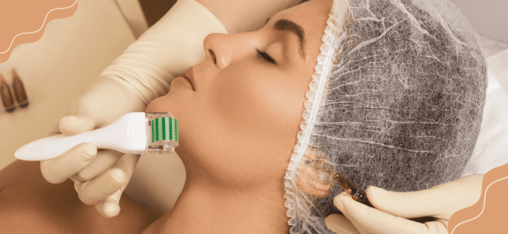 Dermaroller: Onde e quando usar? Entenda tudo sobre essa técnica de microagulhamento! | BCMED