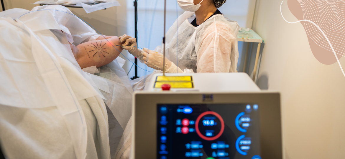Endolaser: A tecnologia para redução de gordura ideal para a sua ...